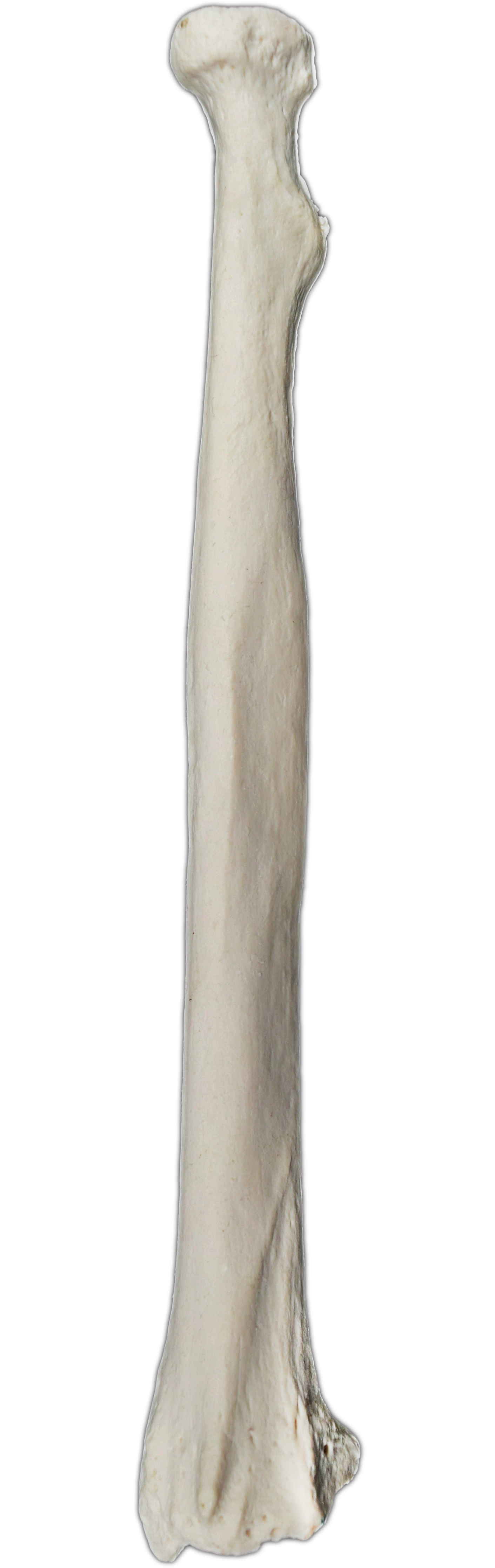 Long Bone Model Anatomy Of A Typical Long Bone MedicineBTG Long Bone Model Anatomy Of A Typical Long Bone MedicineBTG